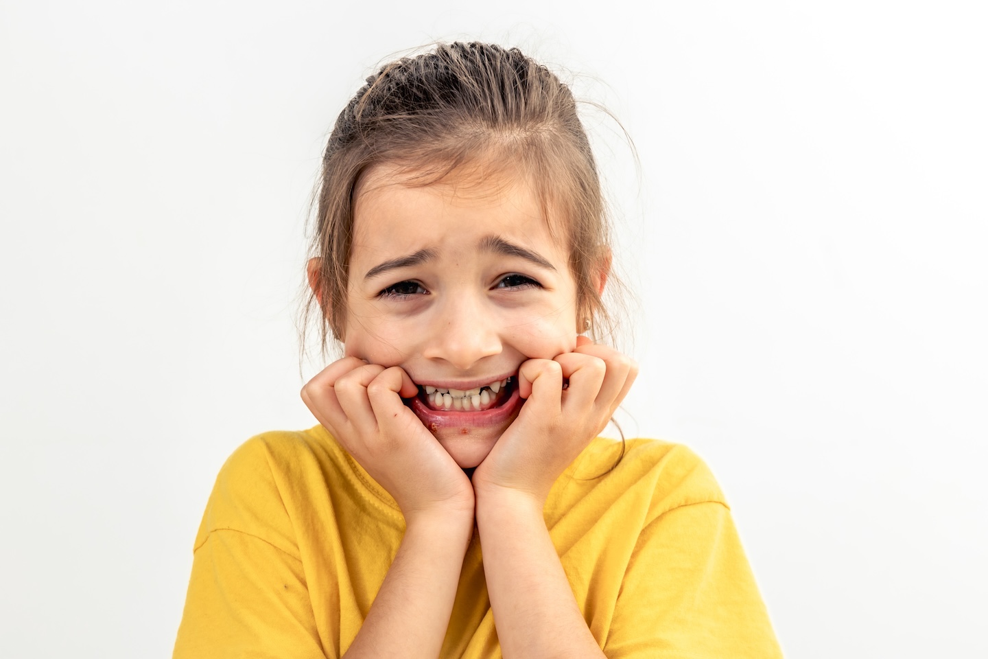 Prevent an overbite in your child - Atlanta Orthodontic Specialists