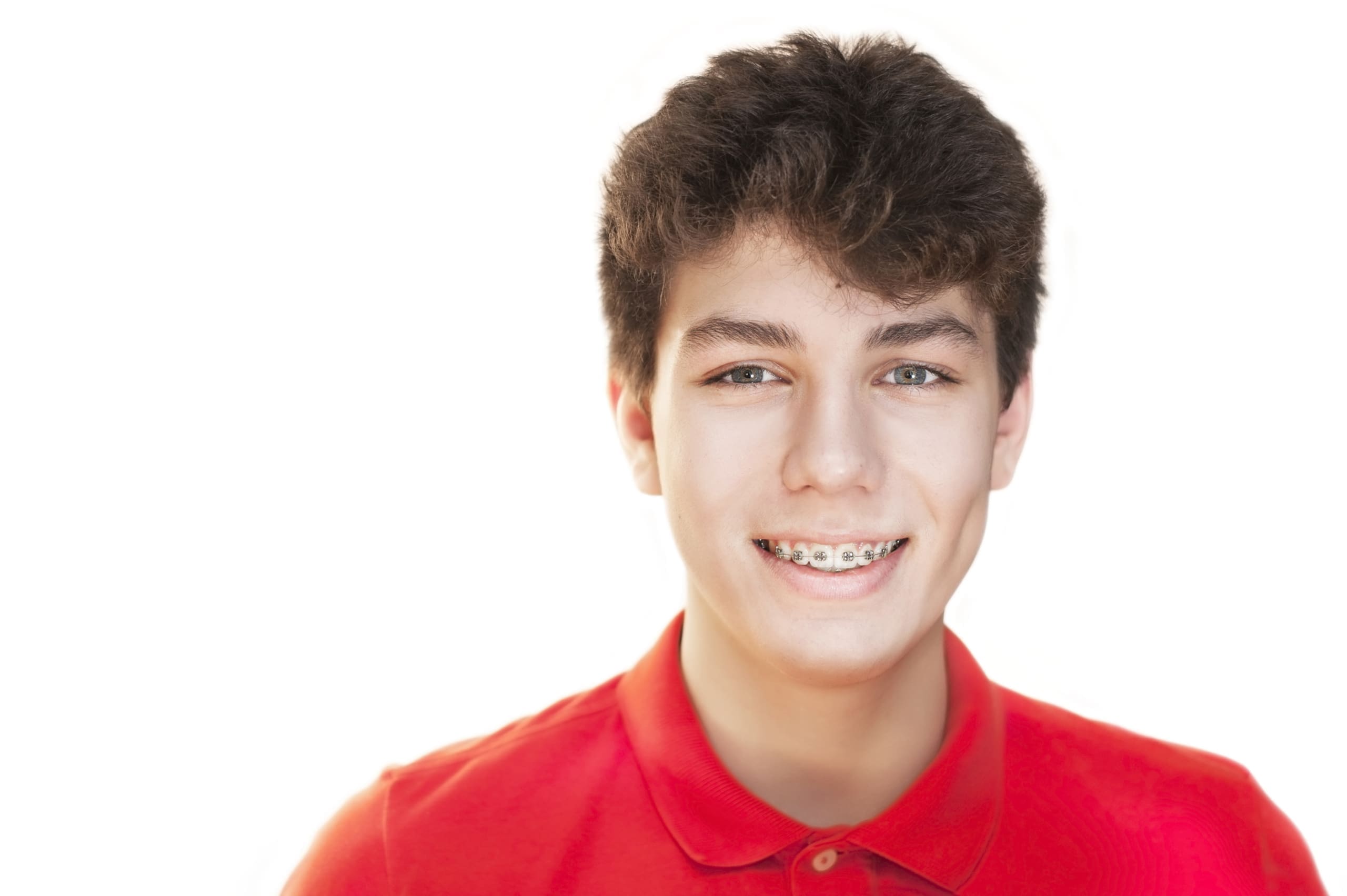 What to Expect When Getting Braces - Atlanta Orthodontic Specialists